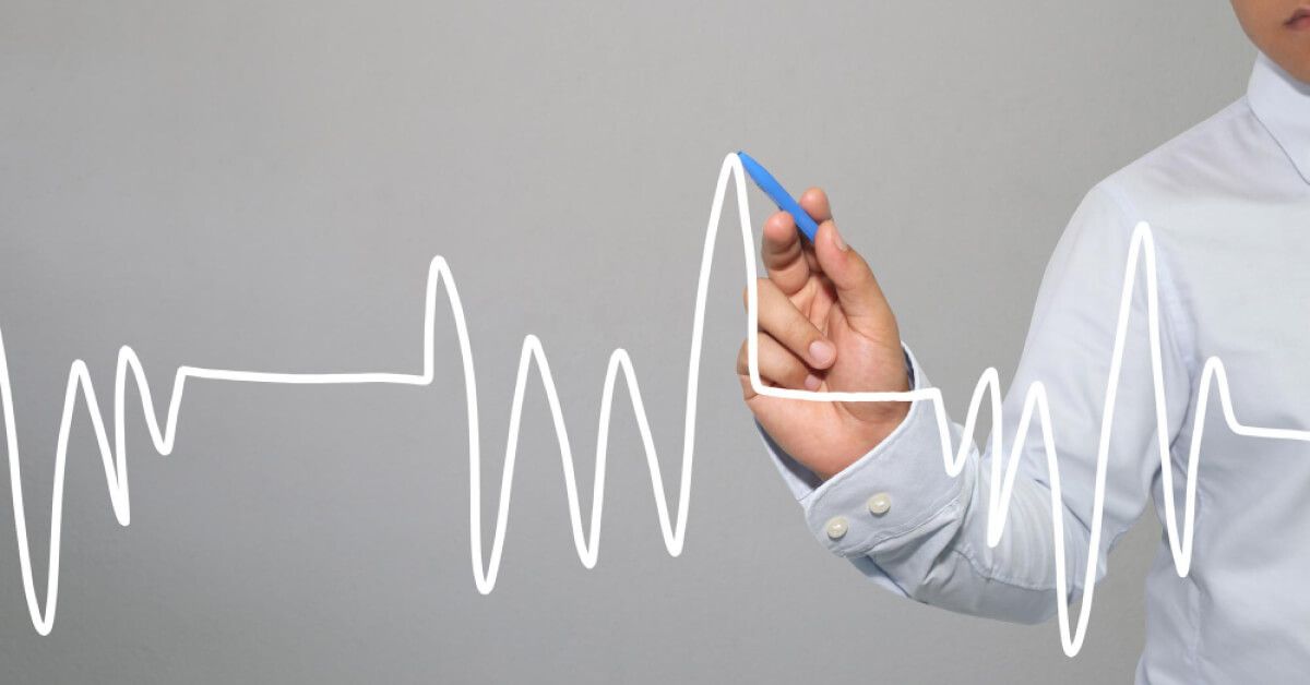 Pulse survey action plan for HR teams that want real change